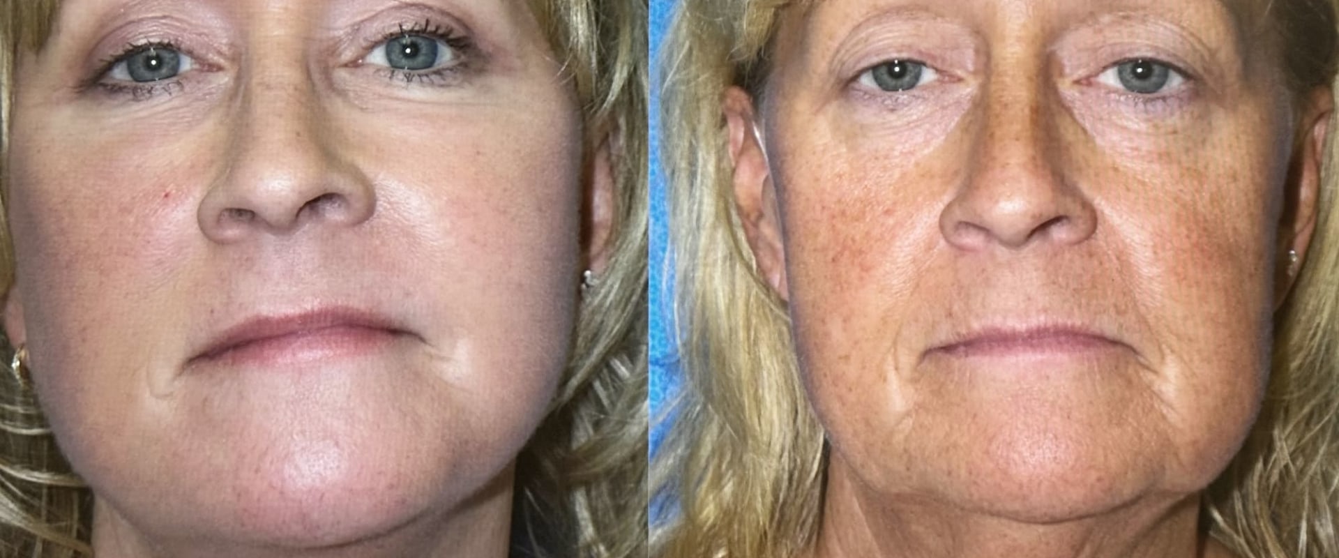 The Revolutionary World of FDA-Approved Stem Cell Therapies: An Expert ...